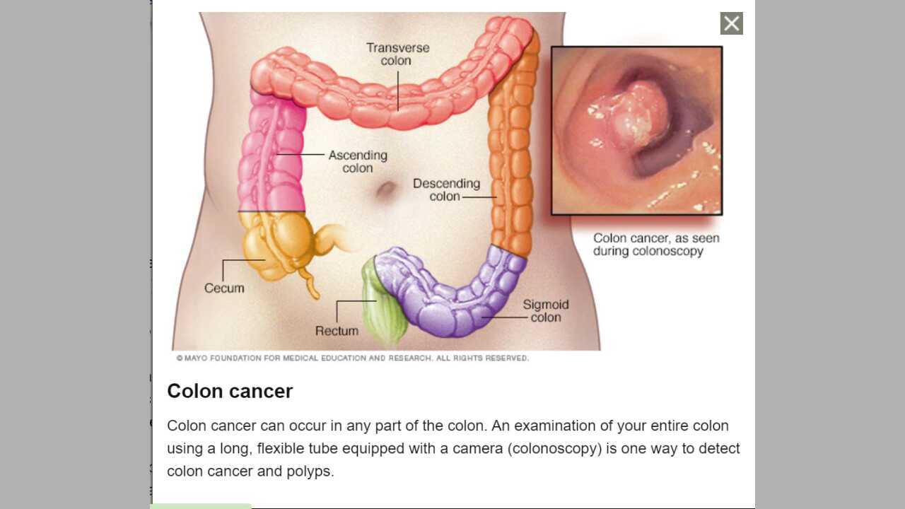 Colonscopy 6208
