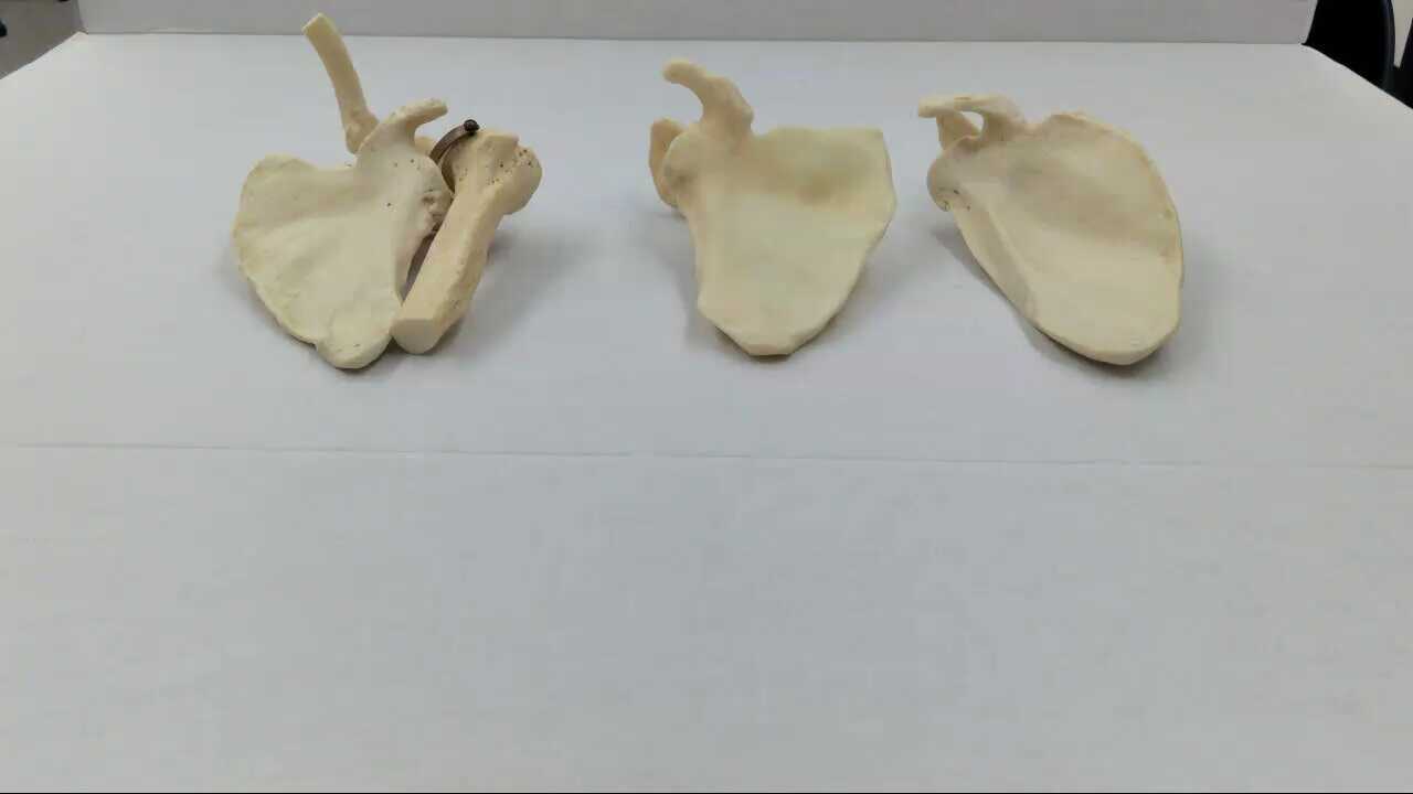 Lab 10 scapula