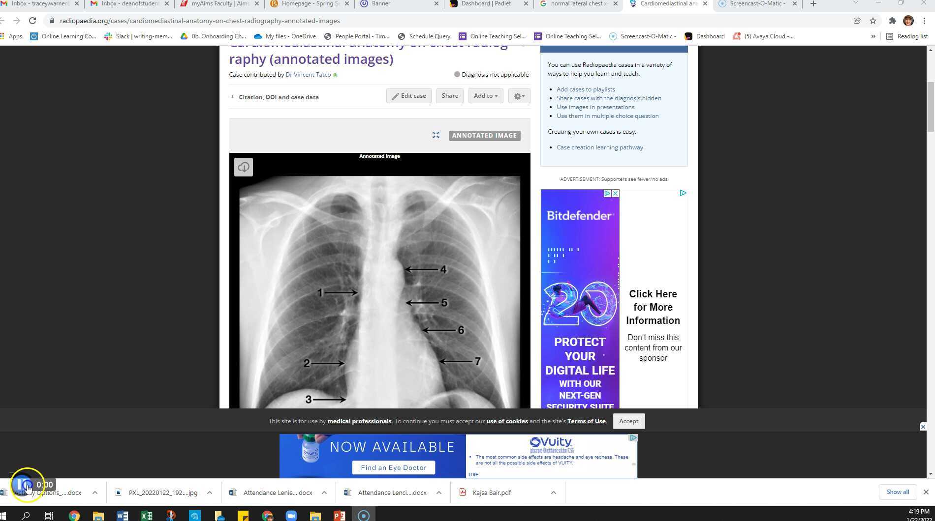 Pathology 2: chest xray anatomy review instructions