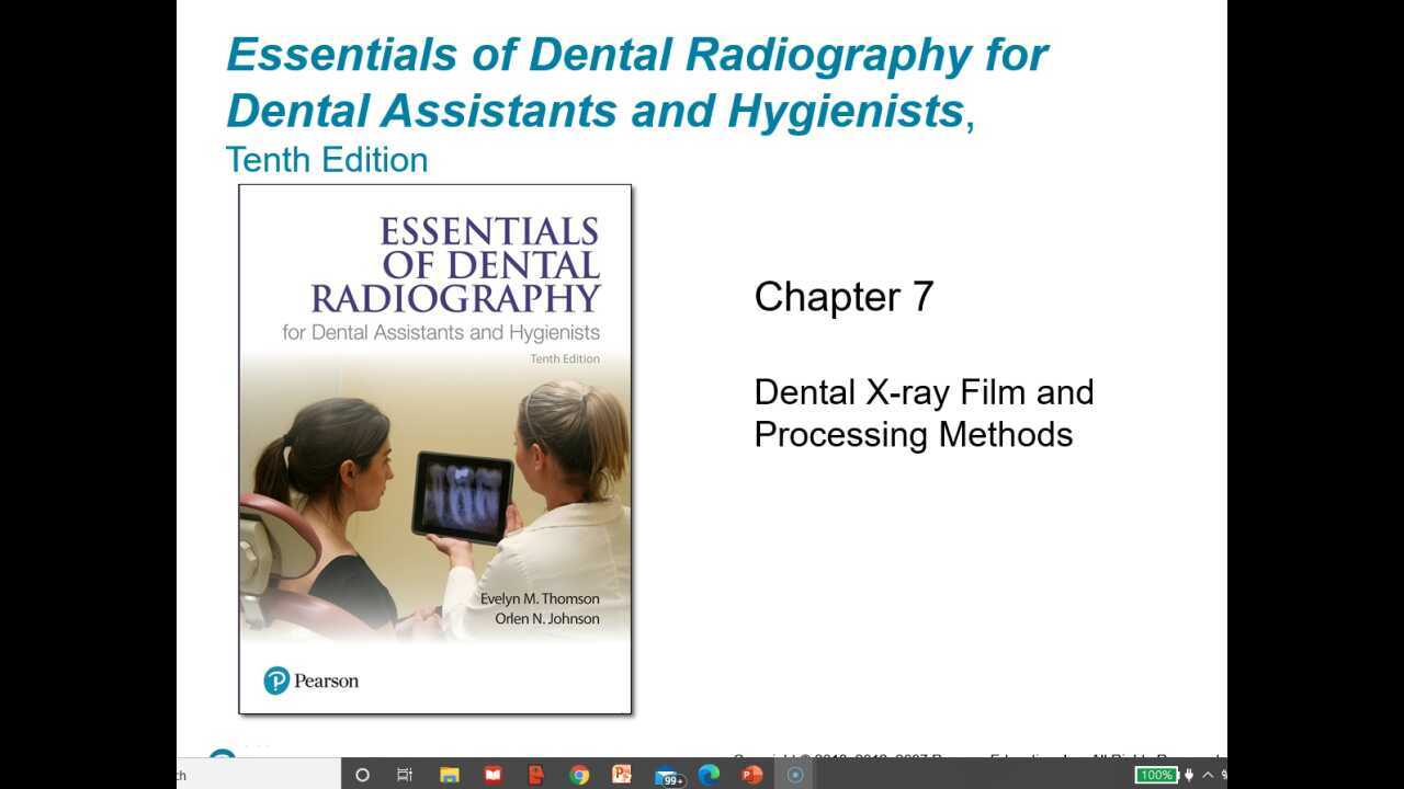 Chapter 7: Dental X-ray Films and Processing Methods