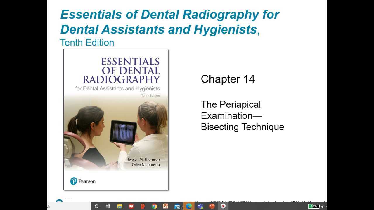Chapter 14:The Periapical Examination-Bisecting Technique