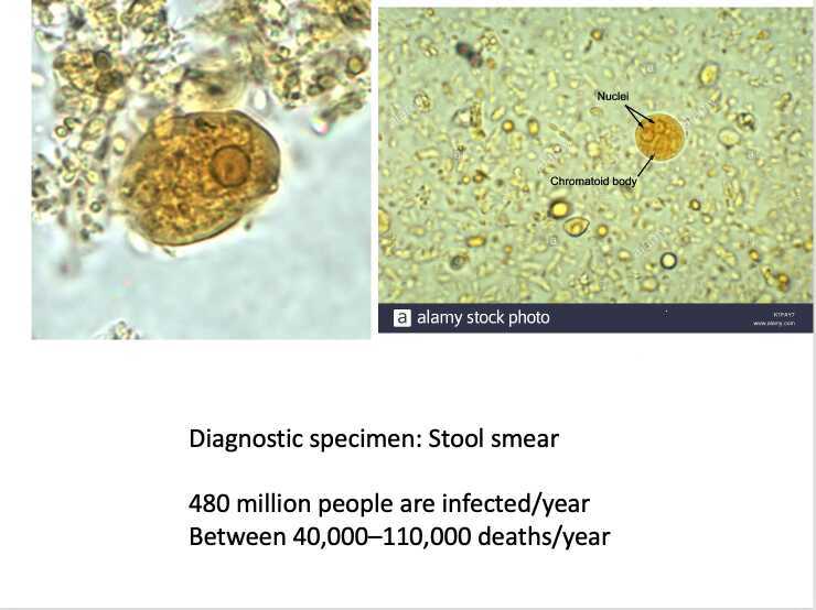 Parasitology PPT 3 Amoeba Slides 11 - 16