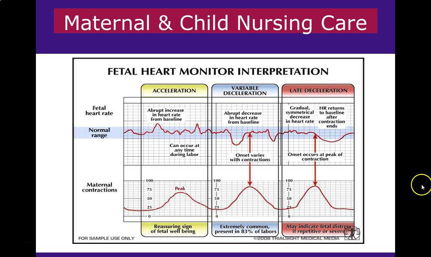 Fetal Heart Rate Interpretation