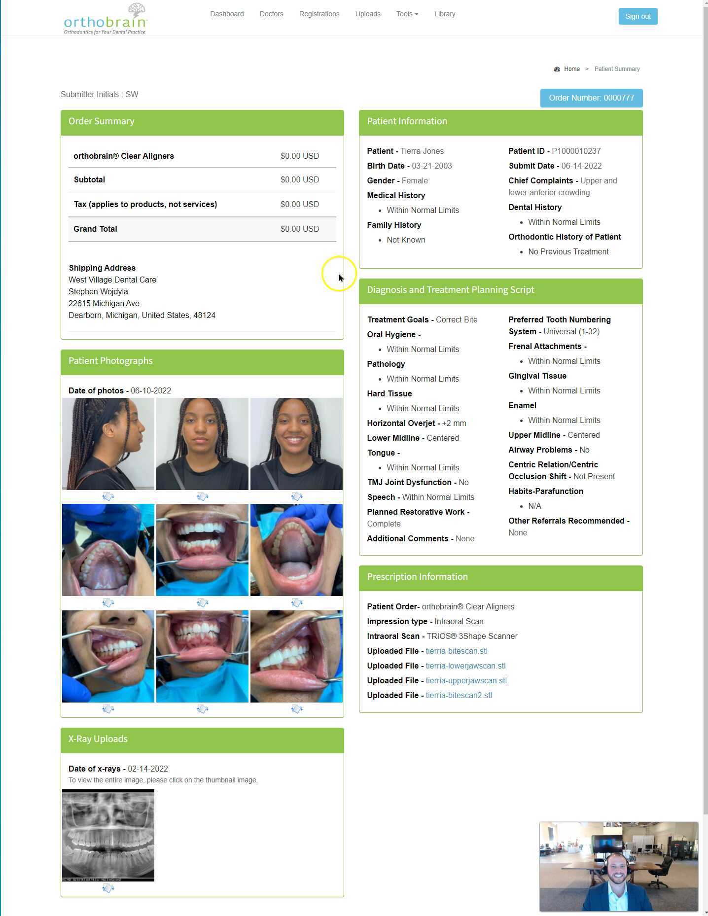 OB Aligners 10237- Class I, moderate arch length deficiency, deep bite ...