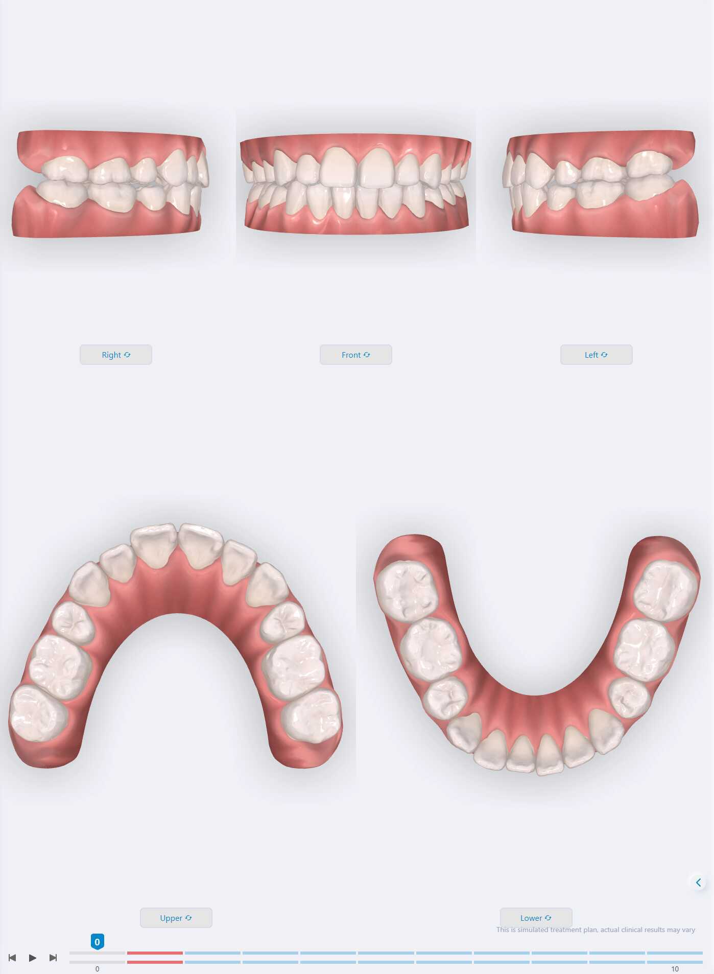 Orthobrain Screencasts