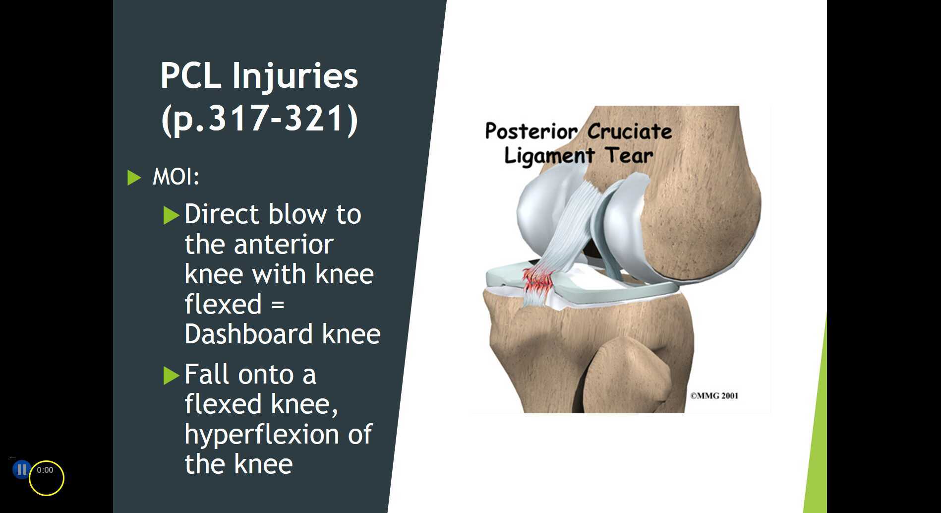PT 250 PCL , MCL, Meniscus