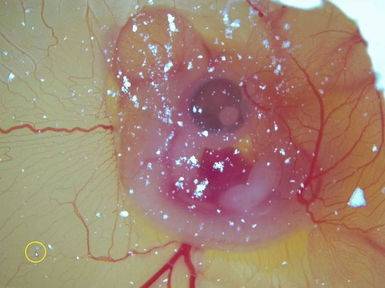 Membrane Dissection #17