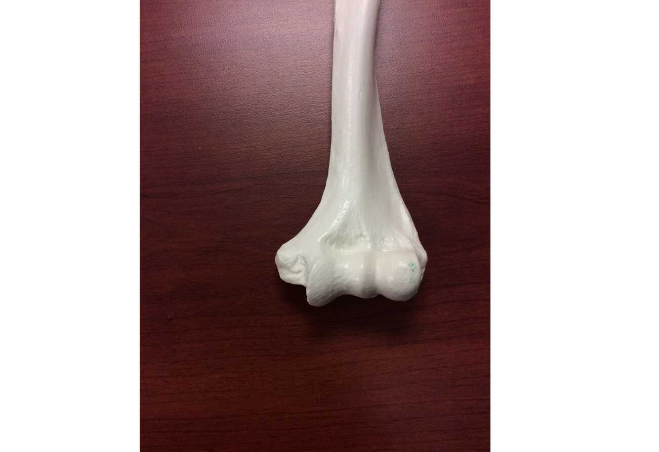 Elbow and Forearm Boney Landmark and Muscle Review