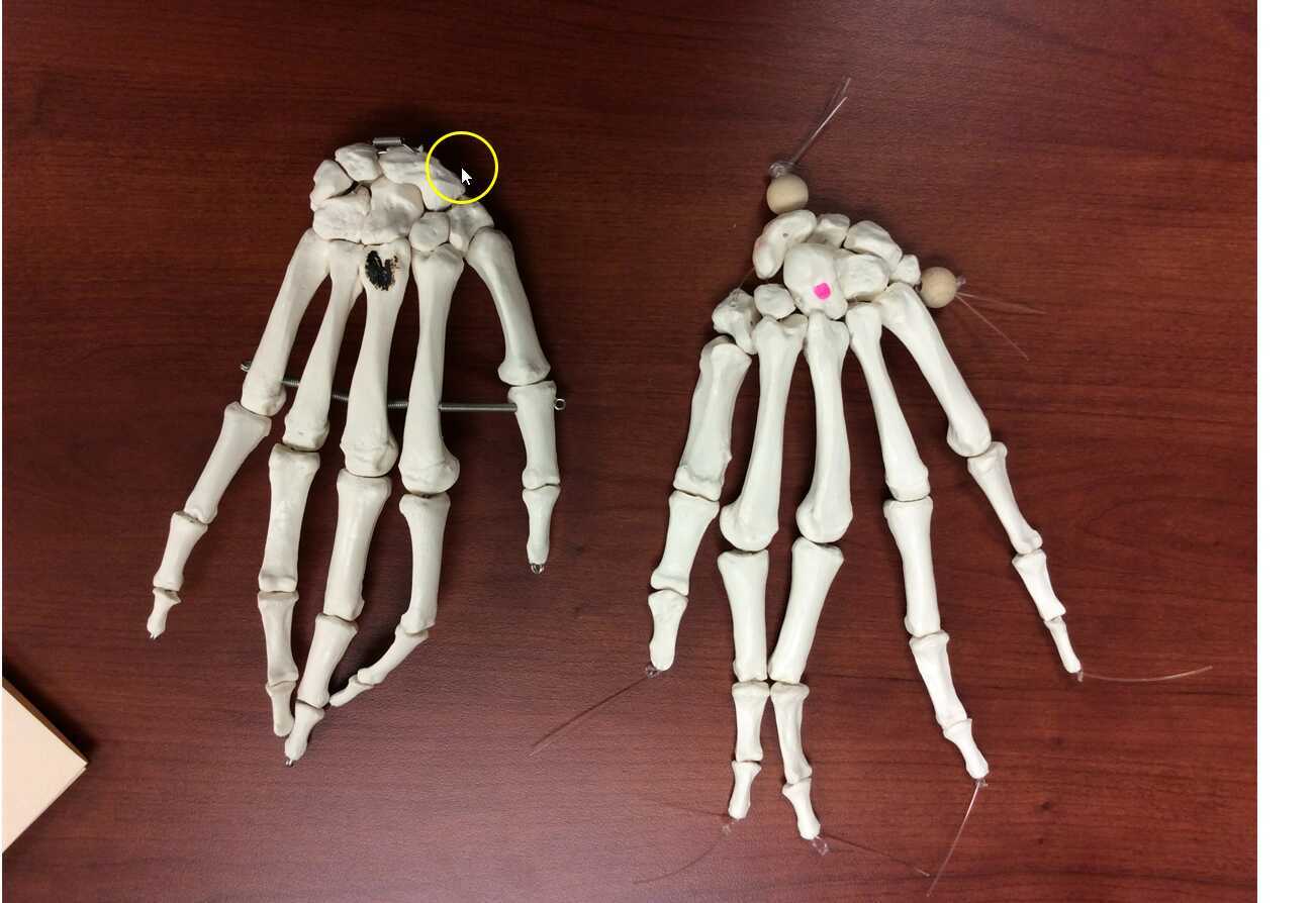 Wrist Boney Landmark and Muscle Identification