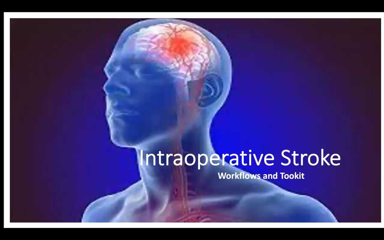 Stroke_Education__Full_presentation