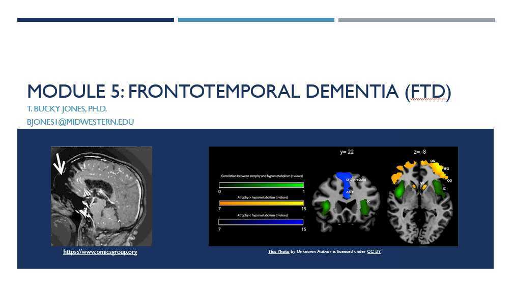 802 Module 5_Frontotemporal Dementia (FTD)