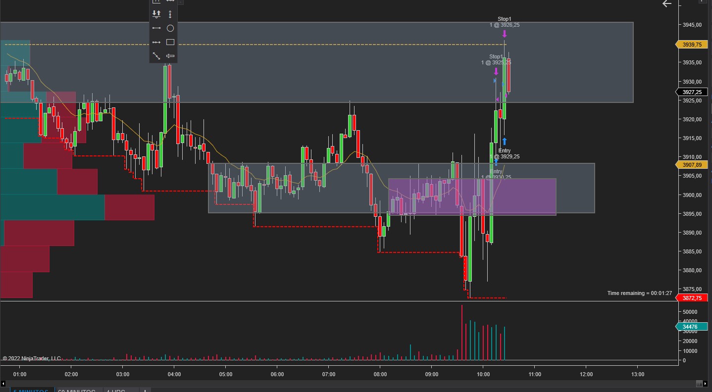 Snip - Chart - 5 MINUTOS (5)